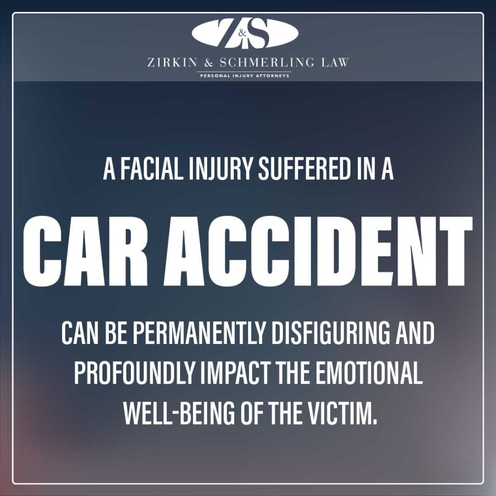 Coping With Car Accident Face Injuries | Zirkin & Schmerling Law