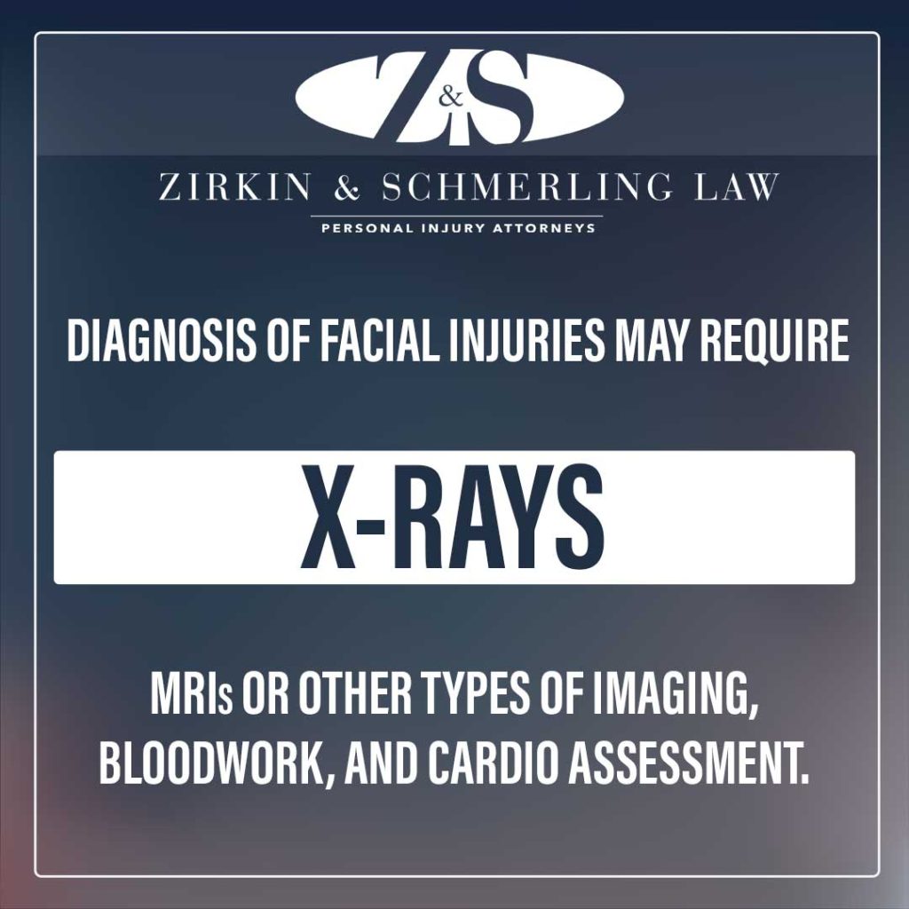 Coping With Car Accident Face Injuries | Zirkin & Schmerling Law